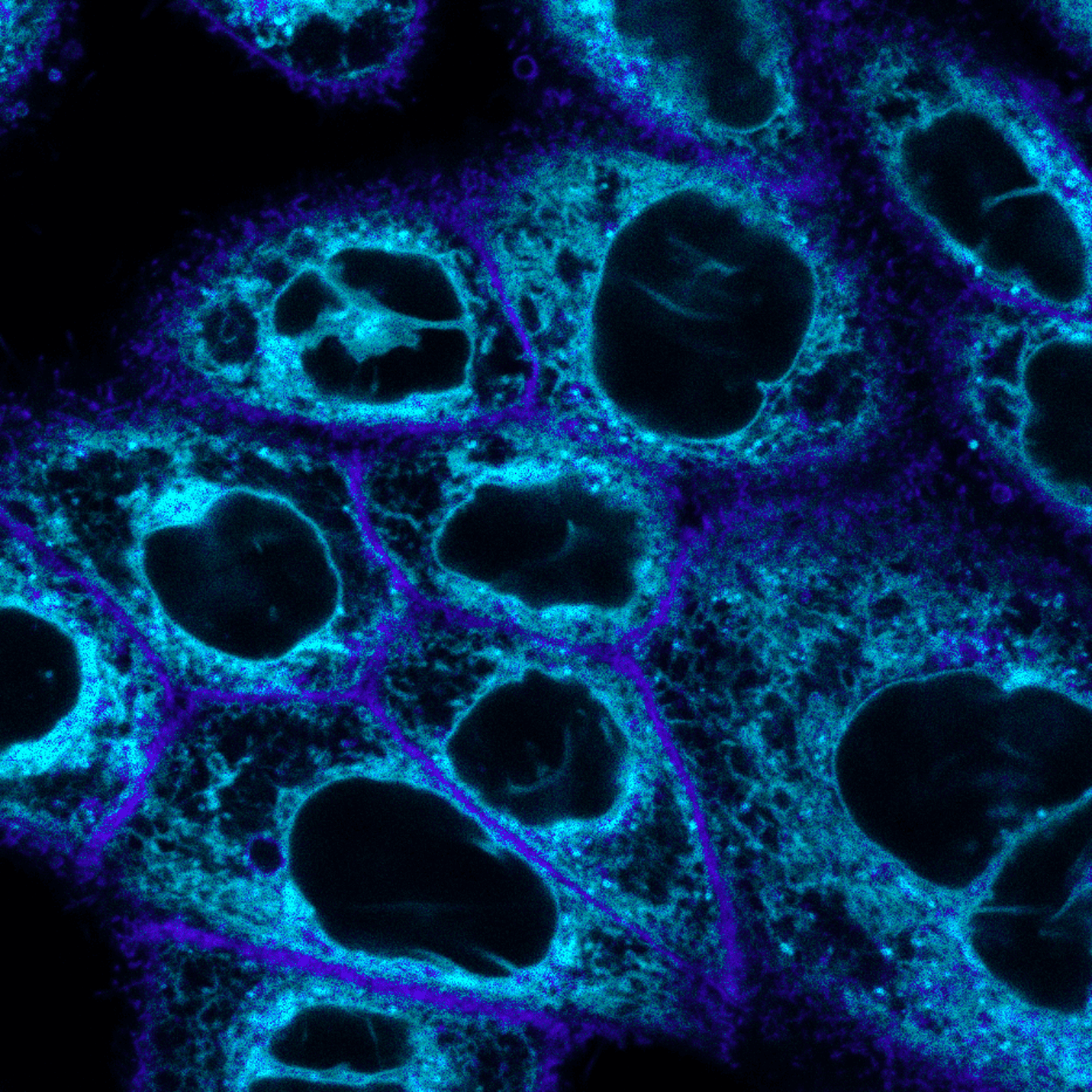 Sirius NeoSight - New view for cancer therapeutic